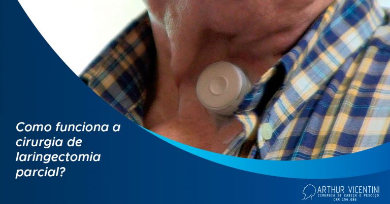 Como Funciona A Cirurgia De Laringectomia Parcial? - Dr. Arthur ...