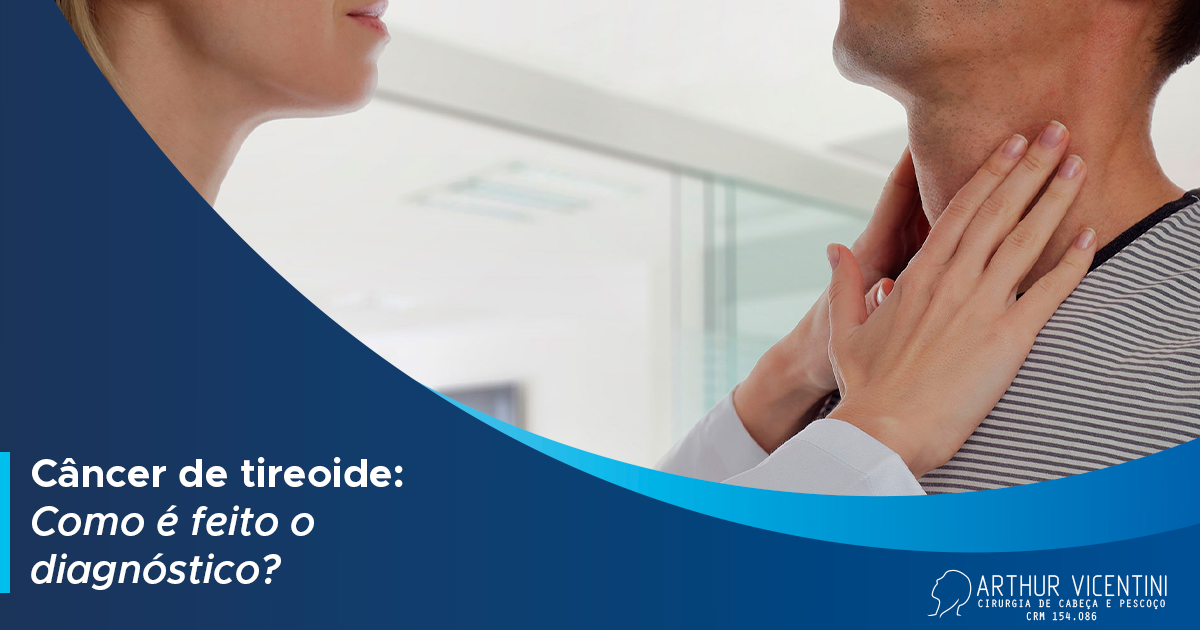Câncer de tireoide: como é feito o diagnóstico? - Dr. Arthur Vicentini ...