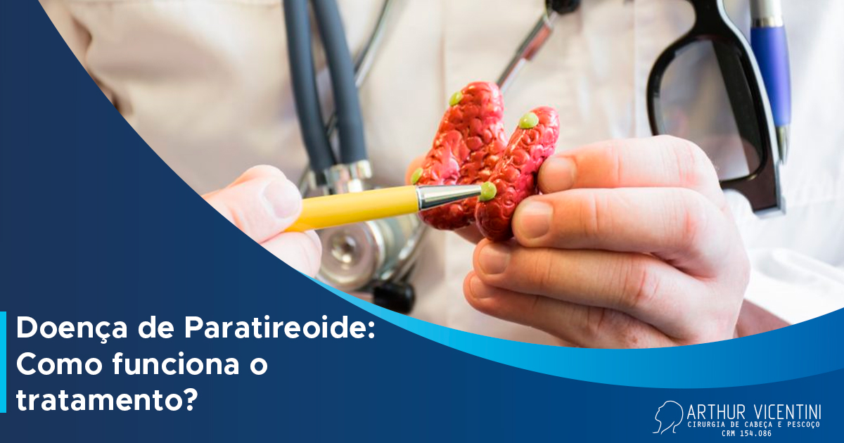 Doenças da Paratireoide: como é o tratamento? - Dr. Arthur Vicentini ...