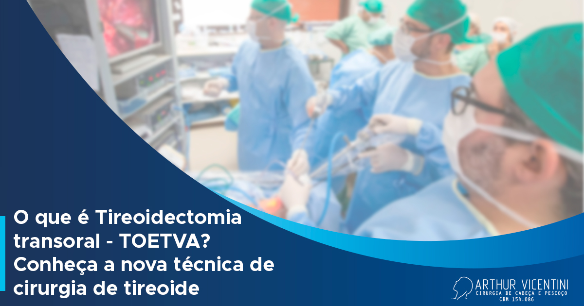 O que é Tireoidectomia Transoral - TOETVA? - Dr. Arthur Vicentini CRM ...