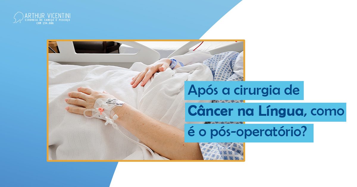 Após A Cirurgia De Câncer Na Língua, Como é O Pós-operatório? - Dr ...