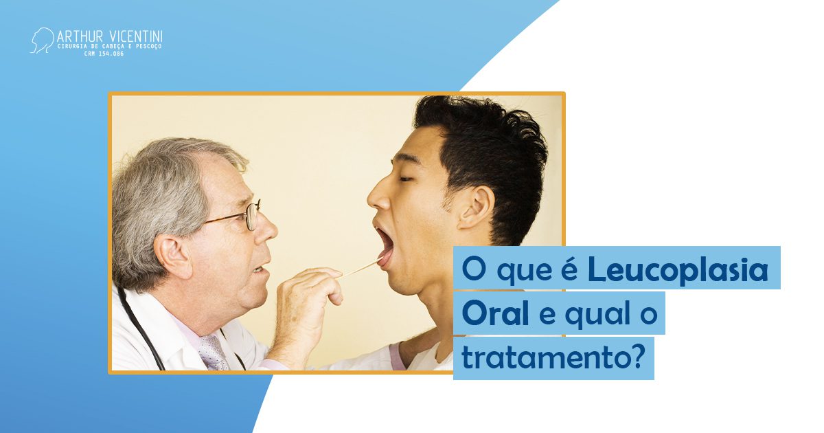 Bochecha De Leucoplasia Leucoplasia Causas: Veja O Que é E O Motivo