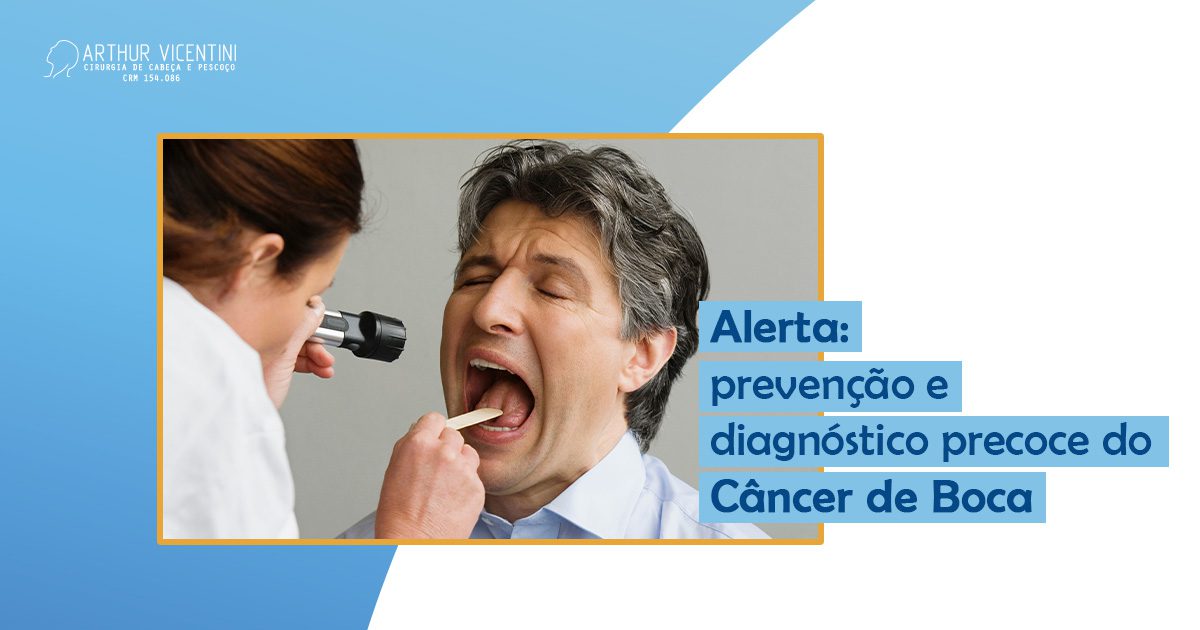 Alerta: Prevenção E Diagnóstico Precoce Do Câncer De Boca - Dr. Arthur ...