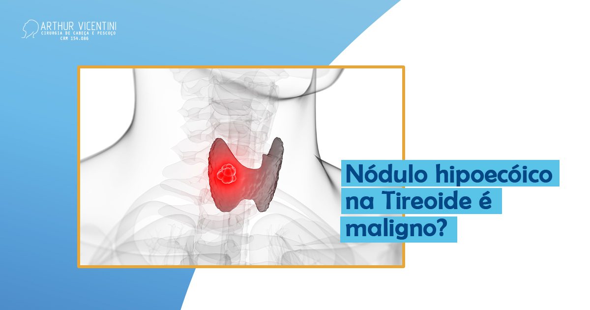 Nódulo Sólido Hipoecóico De Contornos Regulares Na Tireoide - RETOEDU