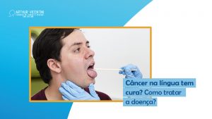 Câncer Na Língua Tem Cura? Como Tratar A Doença? - Dr. Arthur Vicentini ...