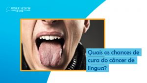 Quais As Chances De Cura Do Câncer De Língua? - Dr. Arthur Vicentini ...