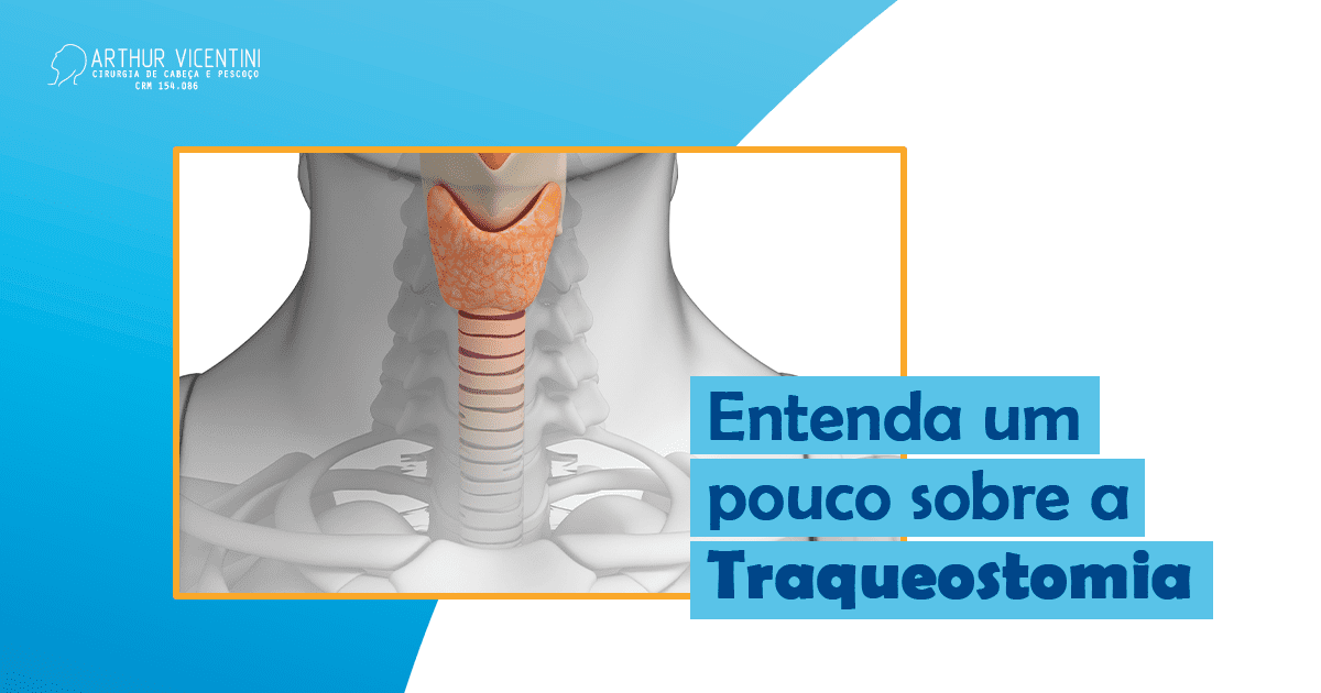 Entenda Um Pouco Sobre A Traqueostomia - Dr. Arthur Vicentini CRM-SP 154086