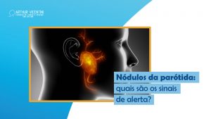 Nódulos Da Parótida: Quais São Os Sinais De Alerta? - Dr. Arthur ...