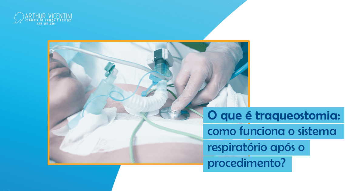 O Que é Traqueostomia: Como Funciona O Sistema Respiratório Após O ...