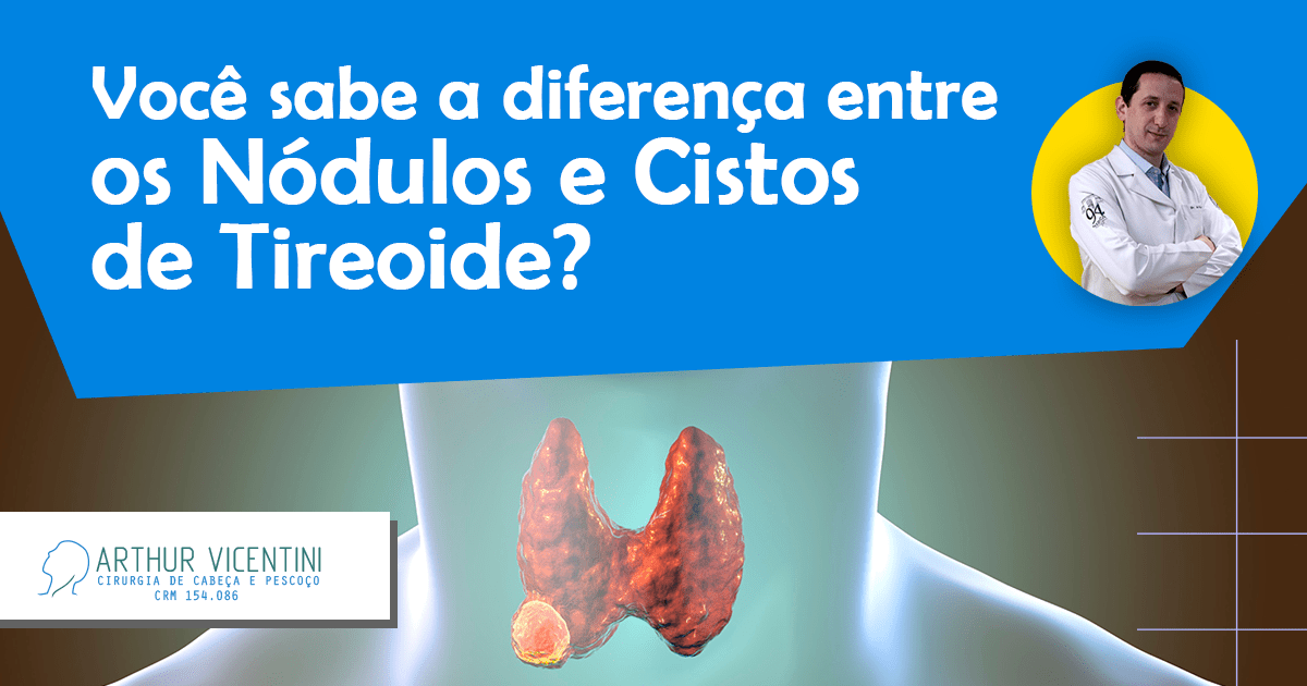 Você Sabe A Diferença Entre Os Nódulos E Cistos De Tireoide? - Dr ...