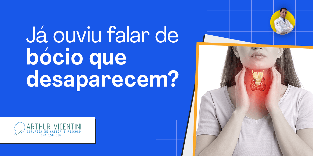 Já Ouviu Falar De Bócio Que Desaparecem? - Dr. Arthur Vicentini CRM-SP ...